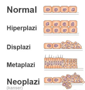 Displazi Nedir? – Sağlık Hakkında Herşey